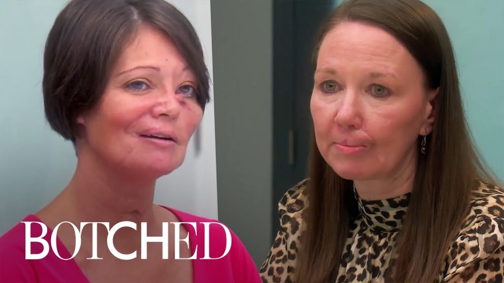 12 Minutes of UNBELIEVABLE Botched Transformations | E! – SocialFlex